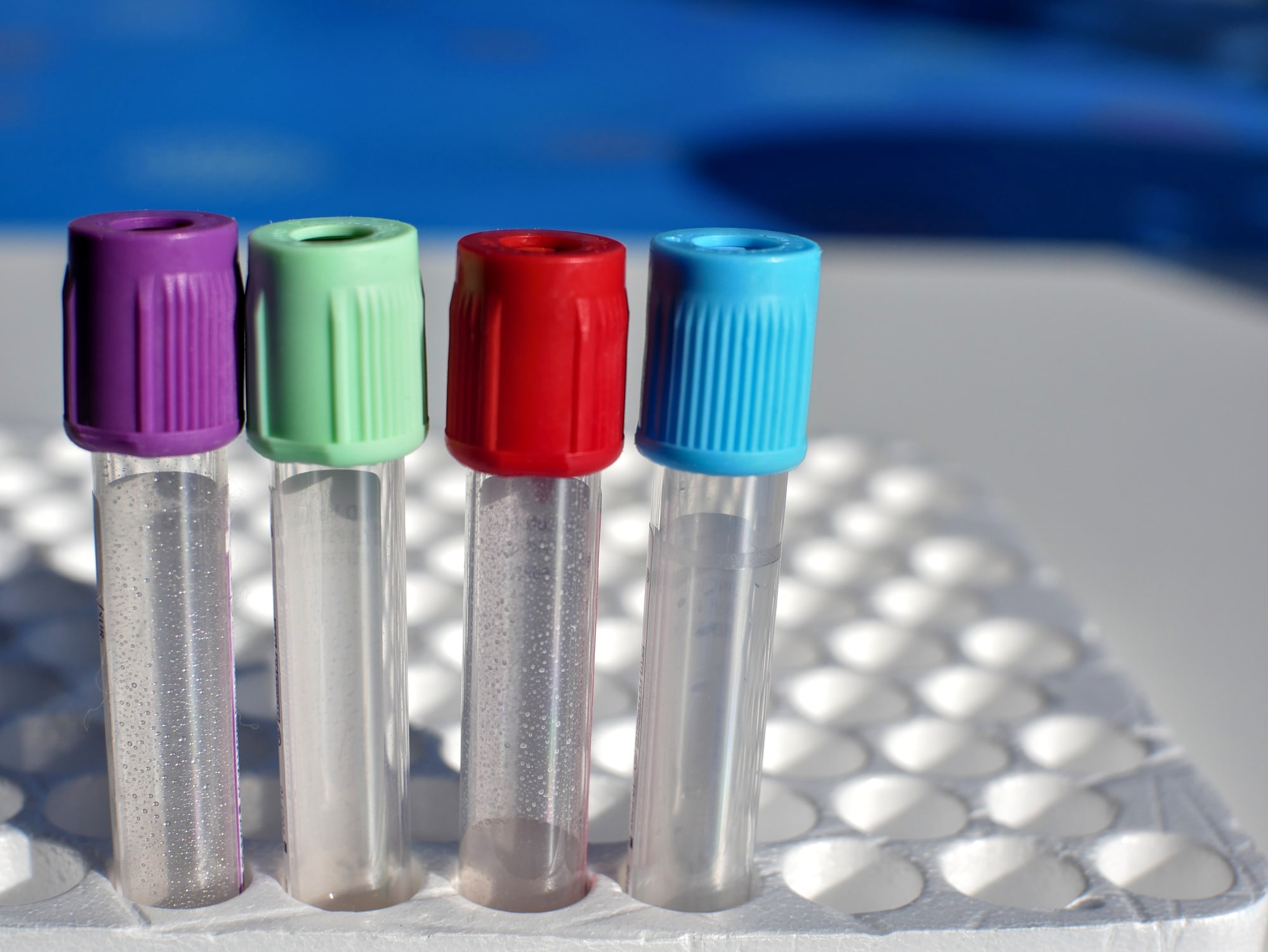 Dépistage gratuit des IST : comment fonctionne « My test IST